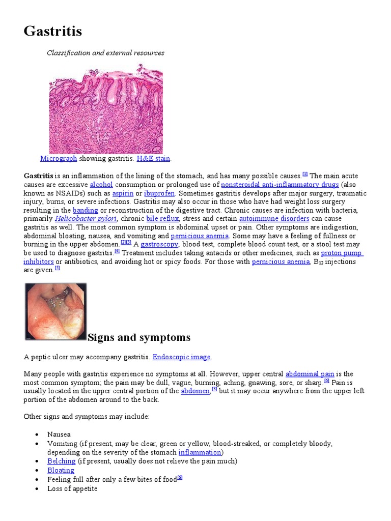 Gastritis: Signs and Symptoms | PDF | Gastroenterology | Clinical Medicine