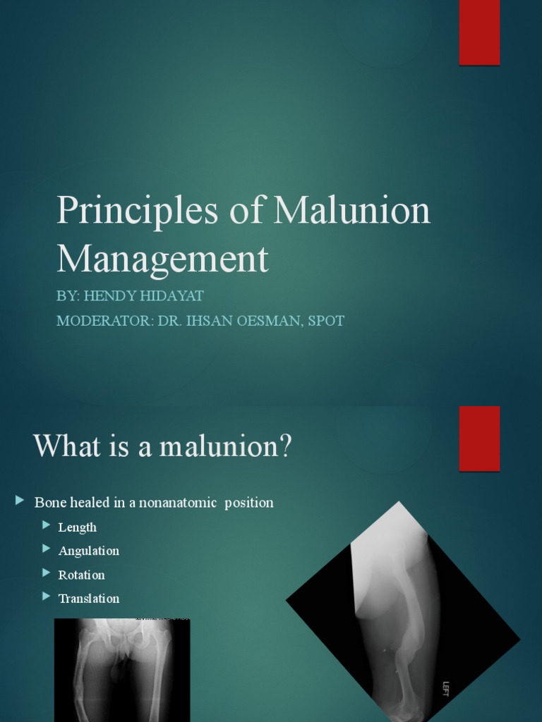Principles of Malunion Management | PDF | Anatomical Terms Of Location ...