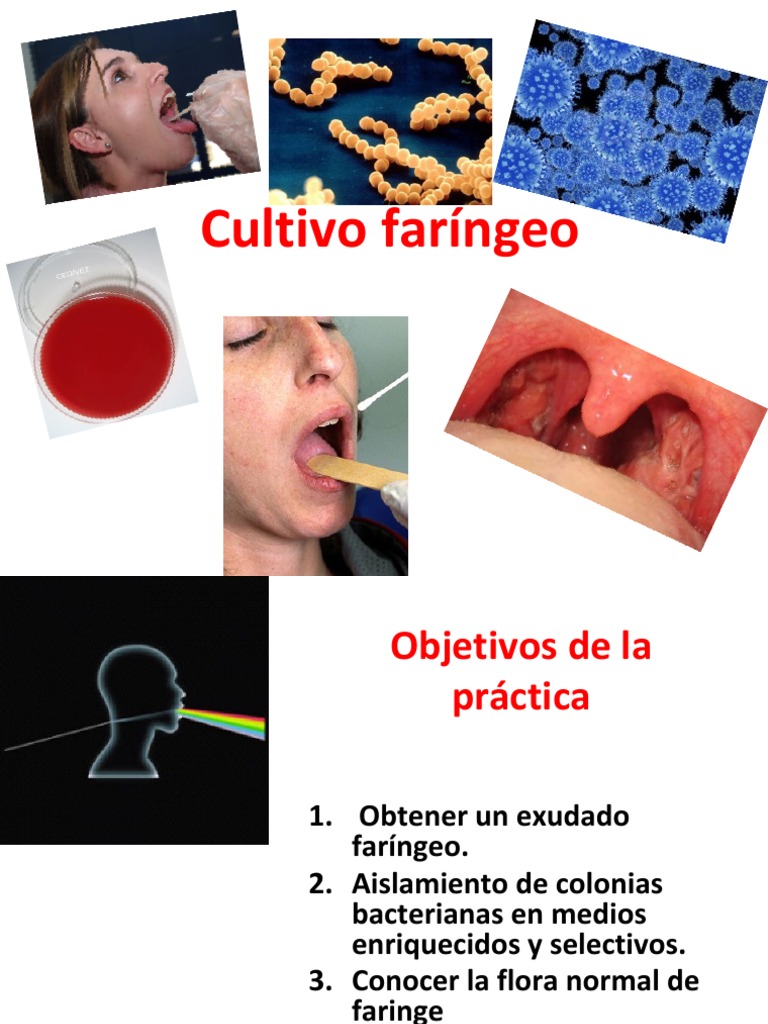 Cultivo Faringeo1 | PDF | Estreptococo | Microorganismo