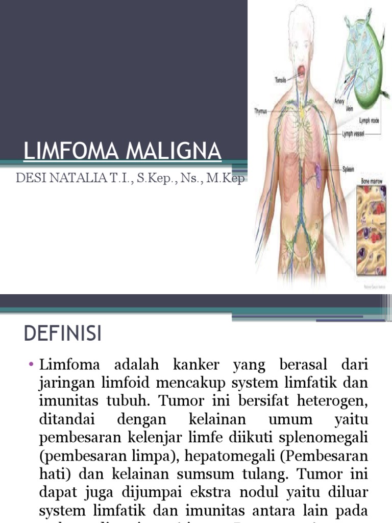 Limfoma Maligna | PDF