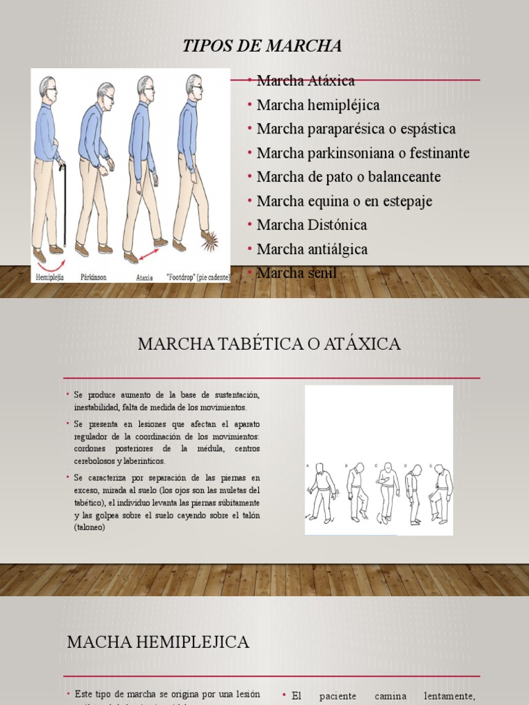 Marchas Patologicas | PDF | Pie | Distonia