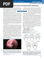 Normal Tonsil Size and Grading Guide | PDF | Infection | Immunology