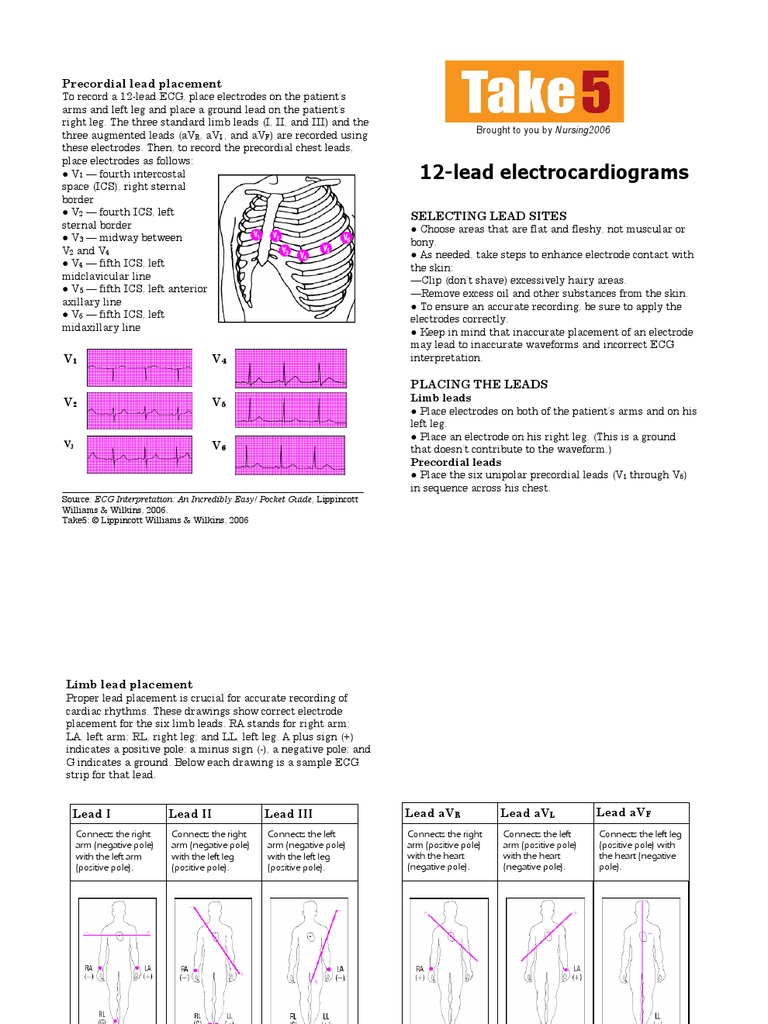 Take5 ECG | PDF | Electrocardiography | Thorax (Human Anatomy)