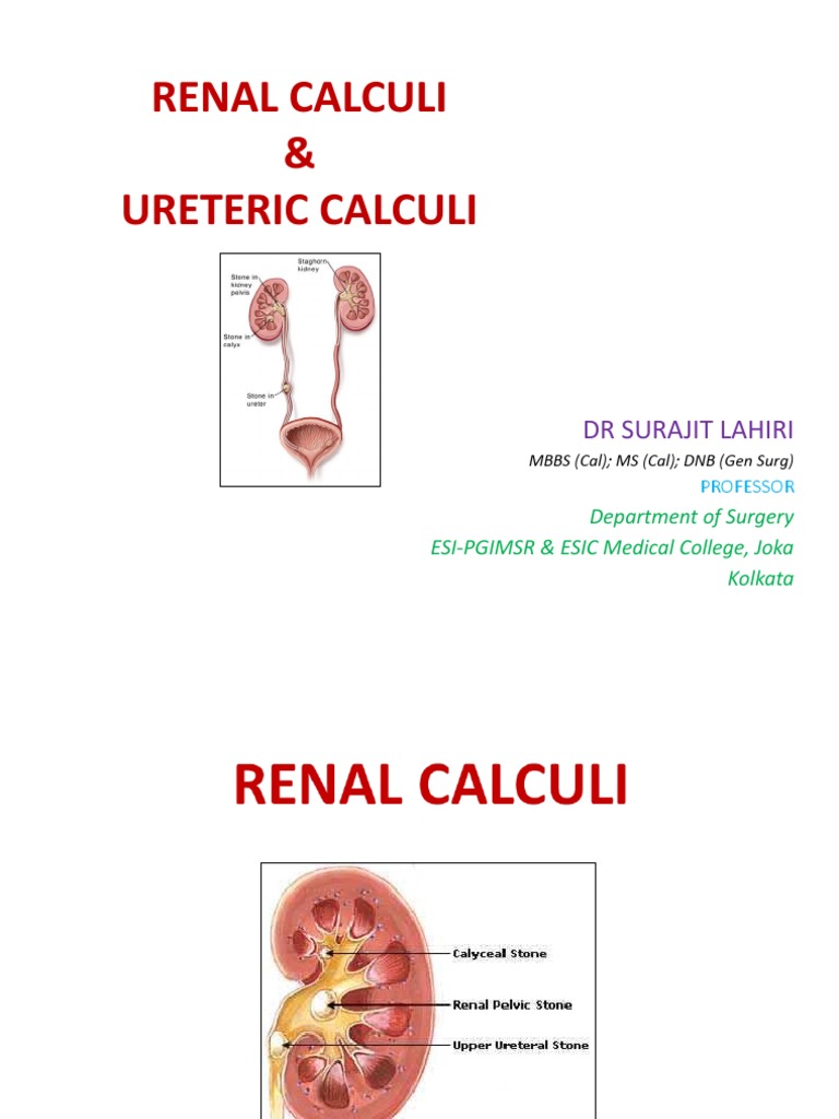 Renal Calculi & Ureteric Calculi: DR Surajit Lahiri | PDF | Kidney ...
