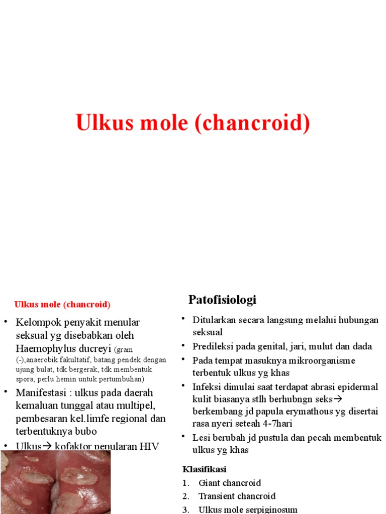 Ulkus Mole (Chancroid) | PDF