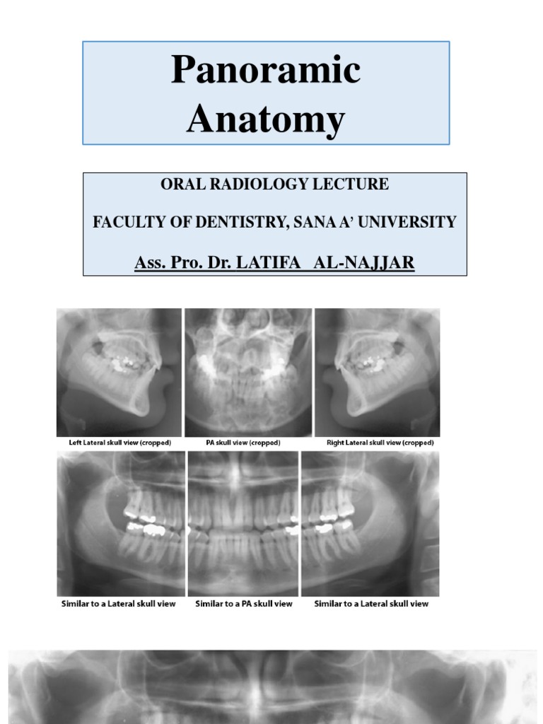 Panoramic Anatomy: Ass. Pro. Dr. Latifa Al-Najjar | Download Free PDF ...