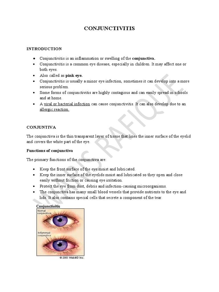 CONJUNCTIVITIS | Download Free PDF | Allergy | Epidemiology