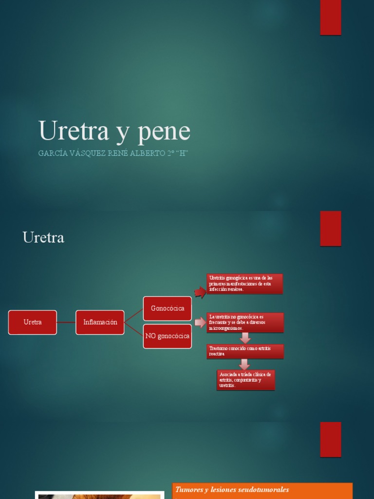 Capitulo 21 Patología Robbins | PDF | Cáncer | Especialidades Medicas