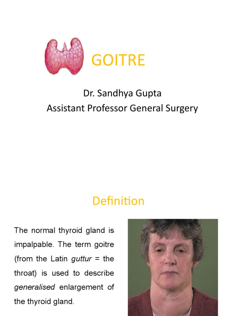Goitre: Dr. Sandhya Gupta Assistant Professor General Surgery ...