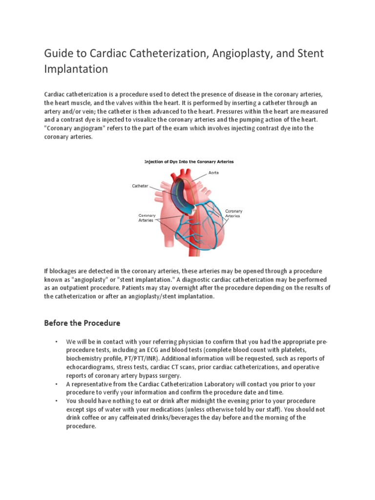 Guide to Cardiac Catheterization, Angioplasty and Stent Procedures ...