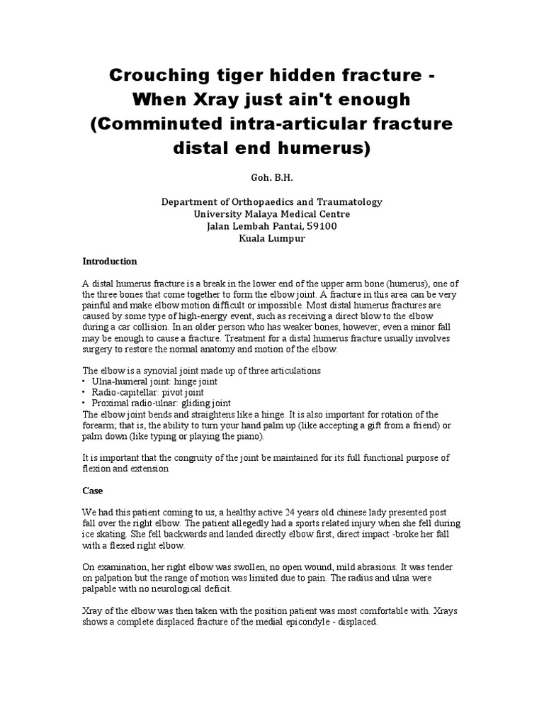 Crouching Tiger Hidden Fracture - When Xray Just Ain't Enough ...