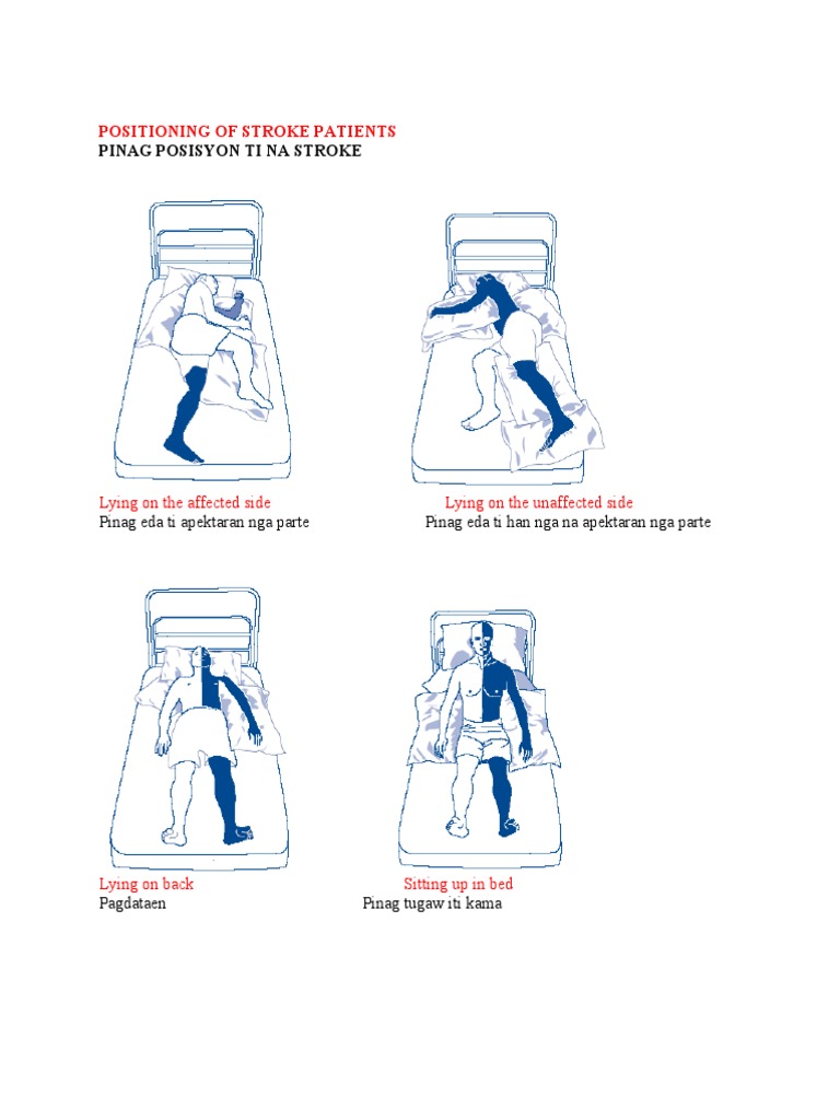 Stroke Patient Positioning Guidelines | PDF | Caregiver | Medical ...
