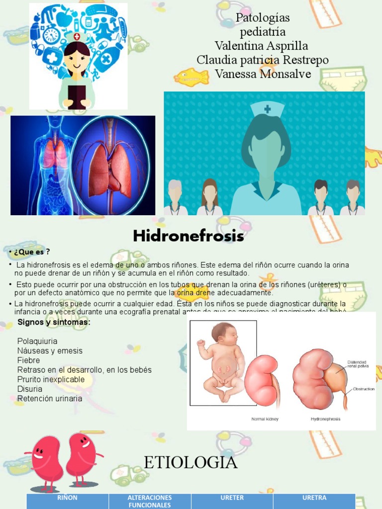 HIDRONEFROSIS | PDF | Riñón | Sistema urinario
