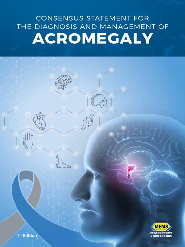 Acromegaly: Consensus Statement For The Diagnosis and Management of ...