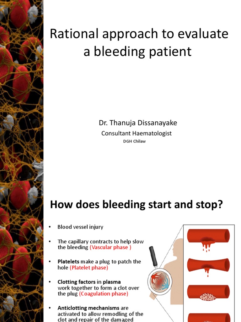 Rational Approach To Evaluate A Bleeding Patient: Dr. Thanuja Dissanayake | PDF | Coagulation ...