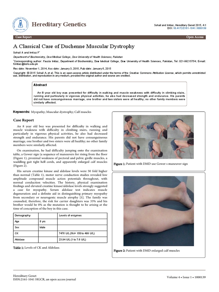 A Classical Case of Duchenne Muscular Dystrophy 2161 1041 4 1000139 ...