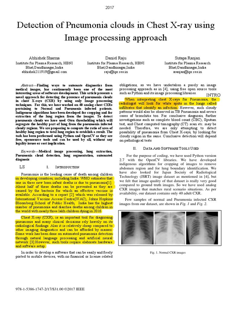 Detection of Pneumonia Clouds in Chest X-Ray Using Image Processing ...