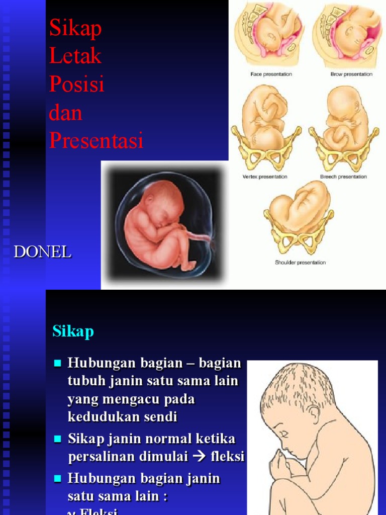 Sikap, Letak, Presentasi Dan Posisi Janin, Pengawasan Intrapartum Dan ...