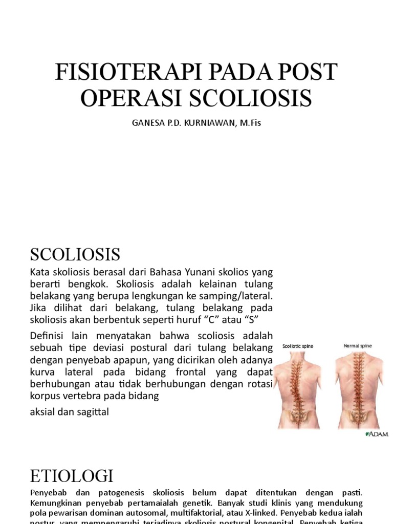 Fisioterapi Pada Post Operasi Scoliosis | PDF | Pengembangan Diri ...