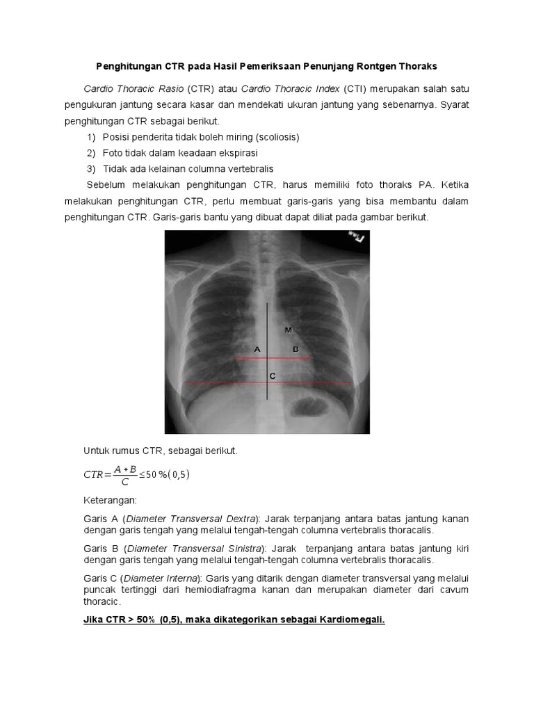 11, 12. SOP Cara Menghitung CTR Dan MAP (HF) | PDF
