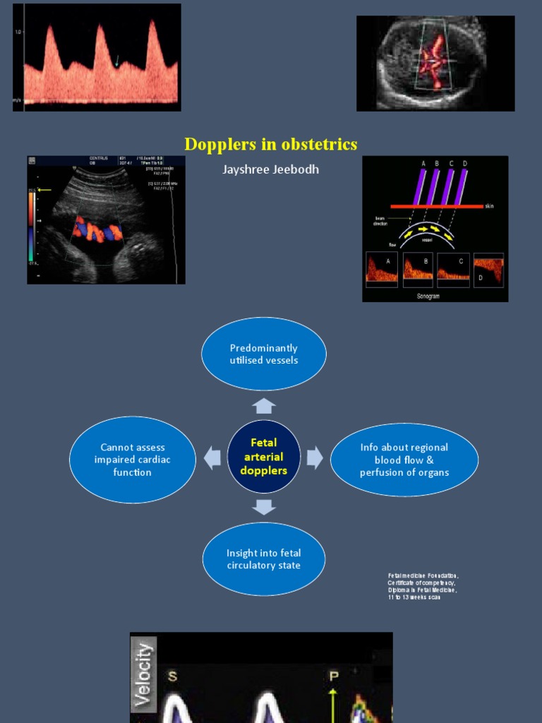 Dopplers in Obstetrics-Final 5th Feb | PDF | Fetus | Prenatal Development