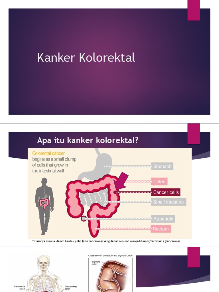Ca. Colorektal | PDF | Colorectal Cancer | Gastroenterology