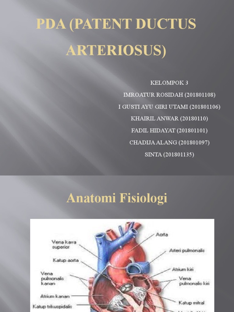 Patent Ductus Arteriosus | PDF