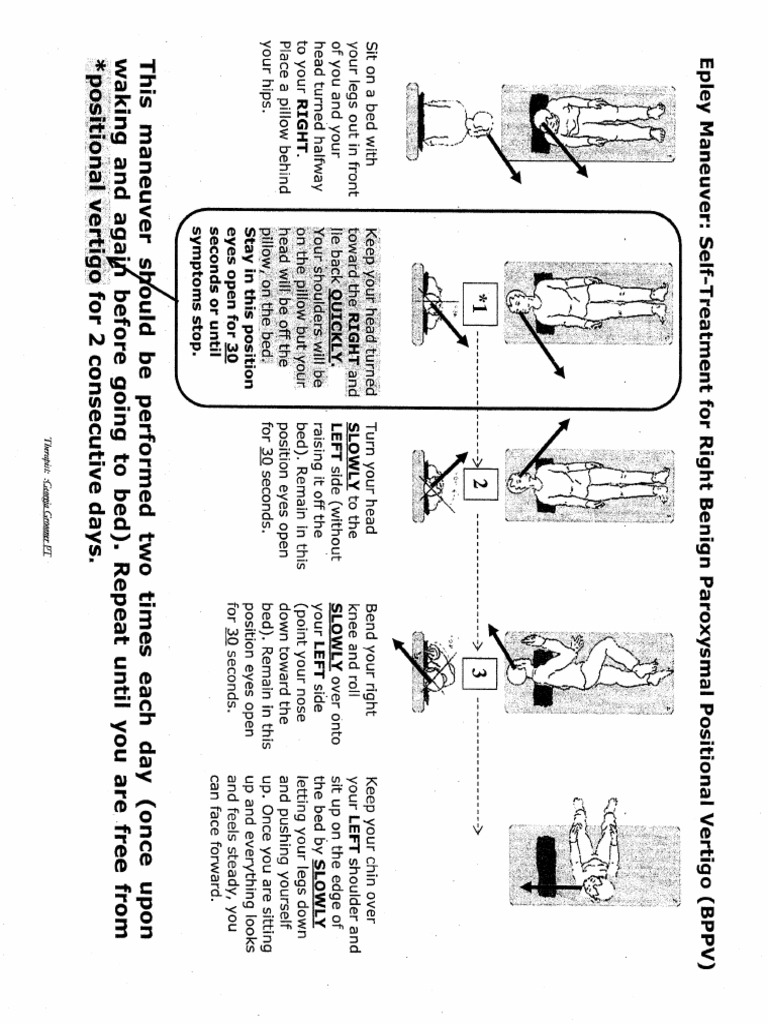 BPPV Exercises | PDF