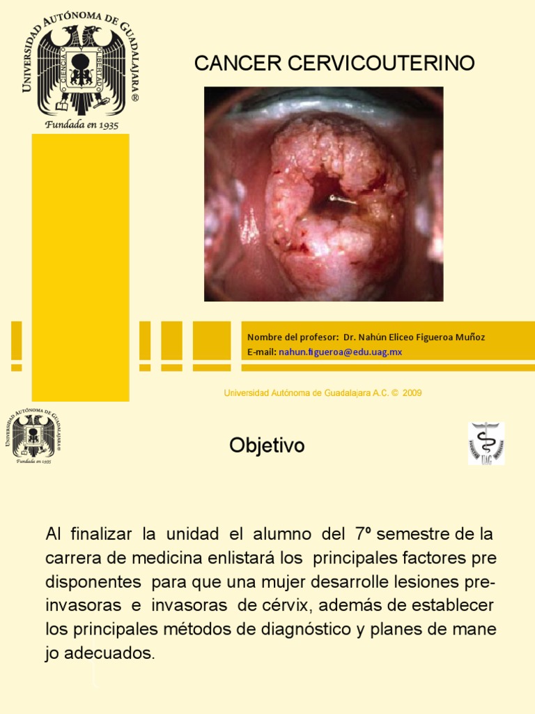 Cáncer Cervicouterino | PDF | Cáncer de cuello uterino | Cáncer