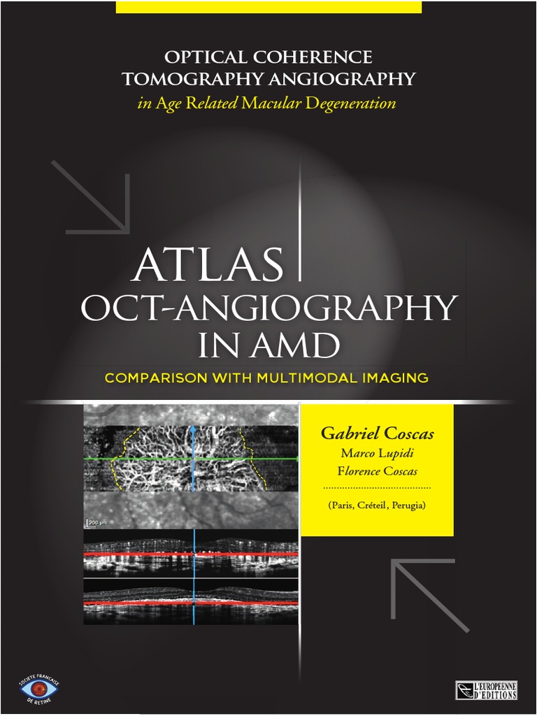ATLAS OCT-A-IN AMD Ebook | PDF | Retina | Angiography