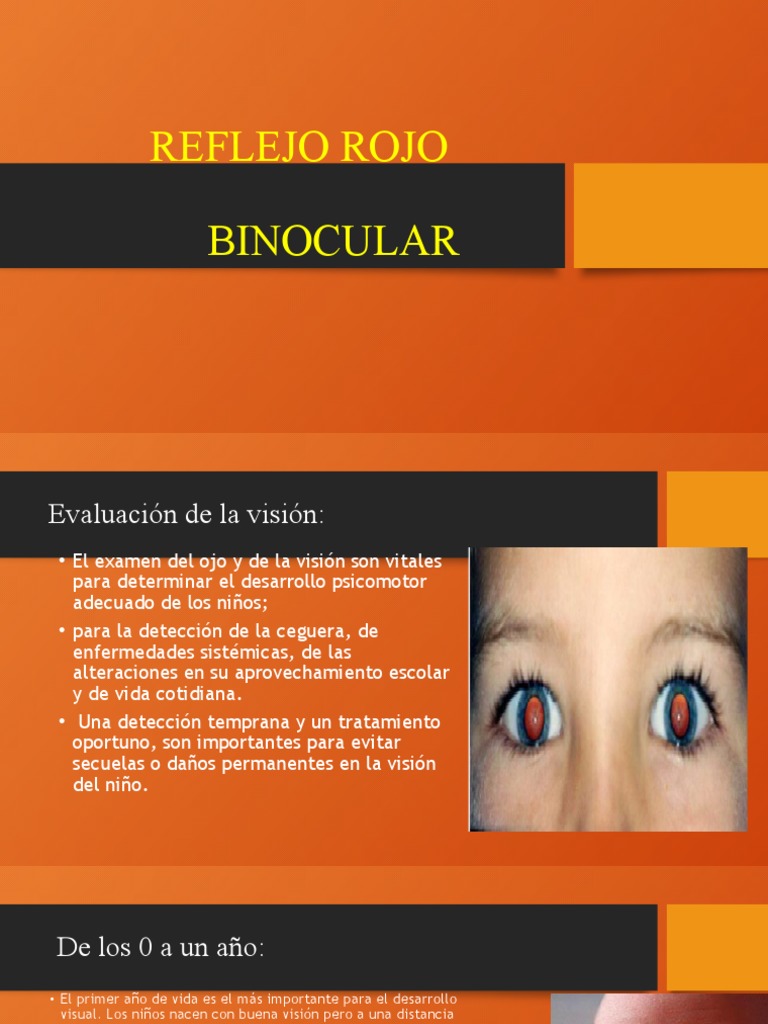 REFLEJO ROJO Expo | PDF | Percepción visual | Ojo humano