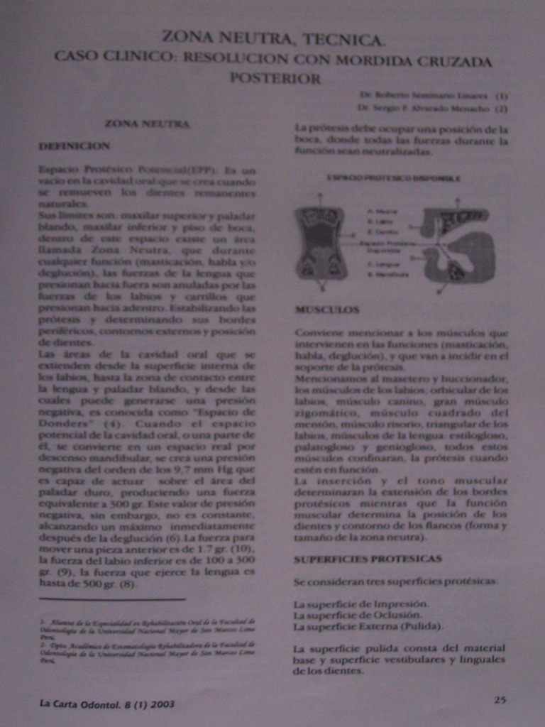 Zona neutra: Técnica | PDF