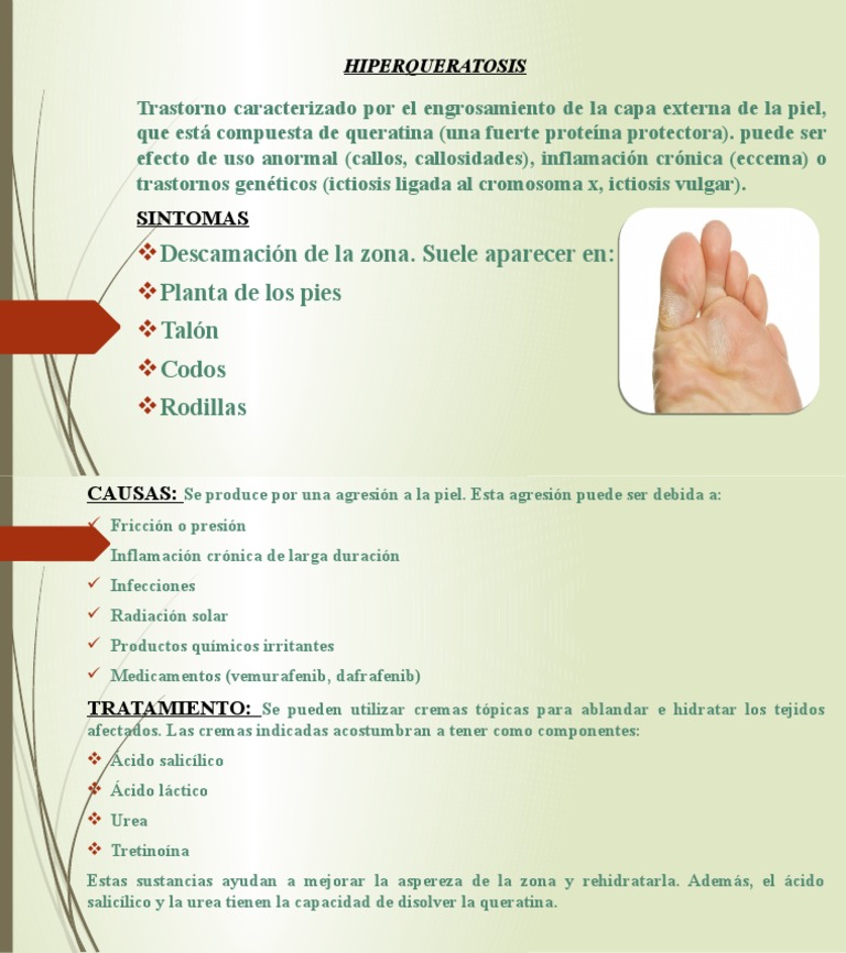 Hiperqueratosis: causas y tratamiento | PDF