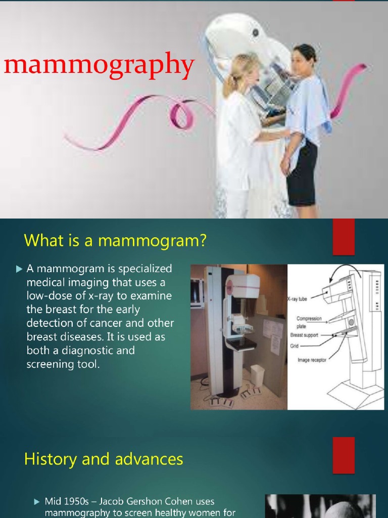 Mammography PDF | PDF