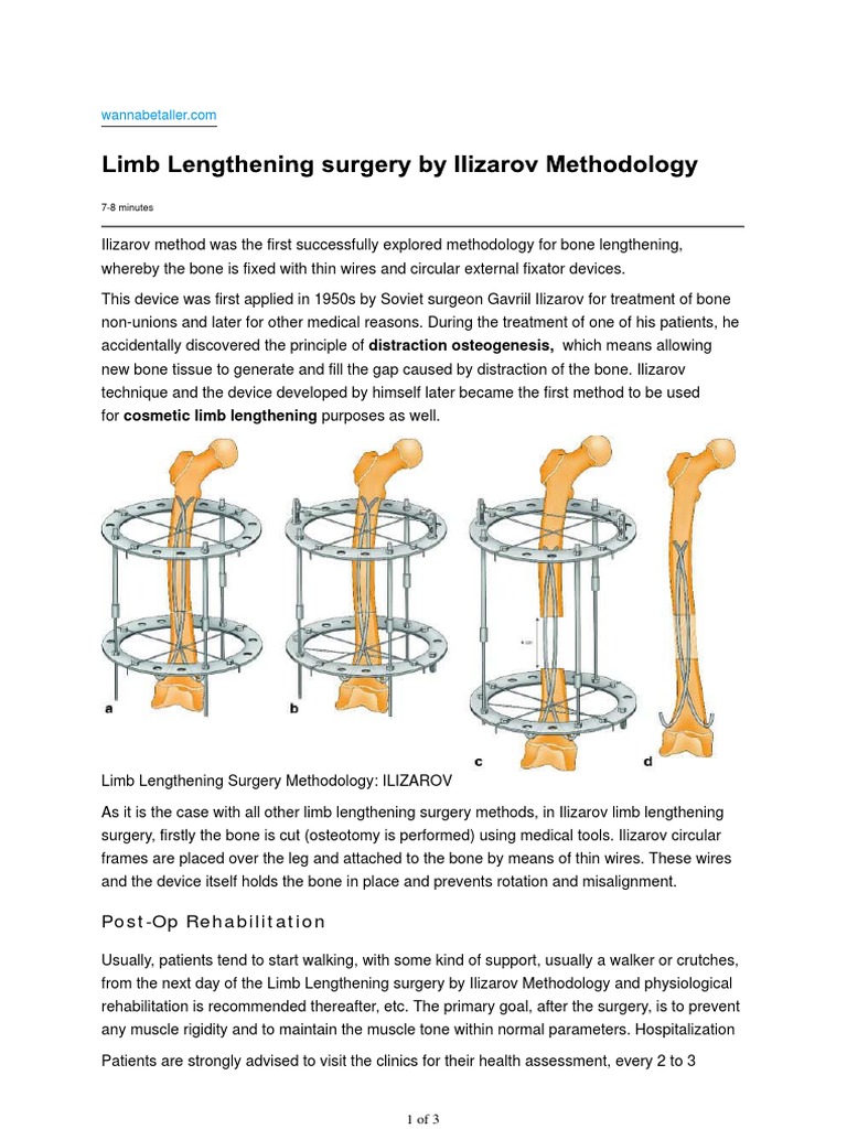 Ilizarov Limb Lengthening Overview | PDF | Surgery | Surgical Specialties