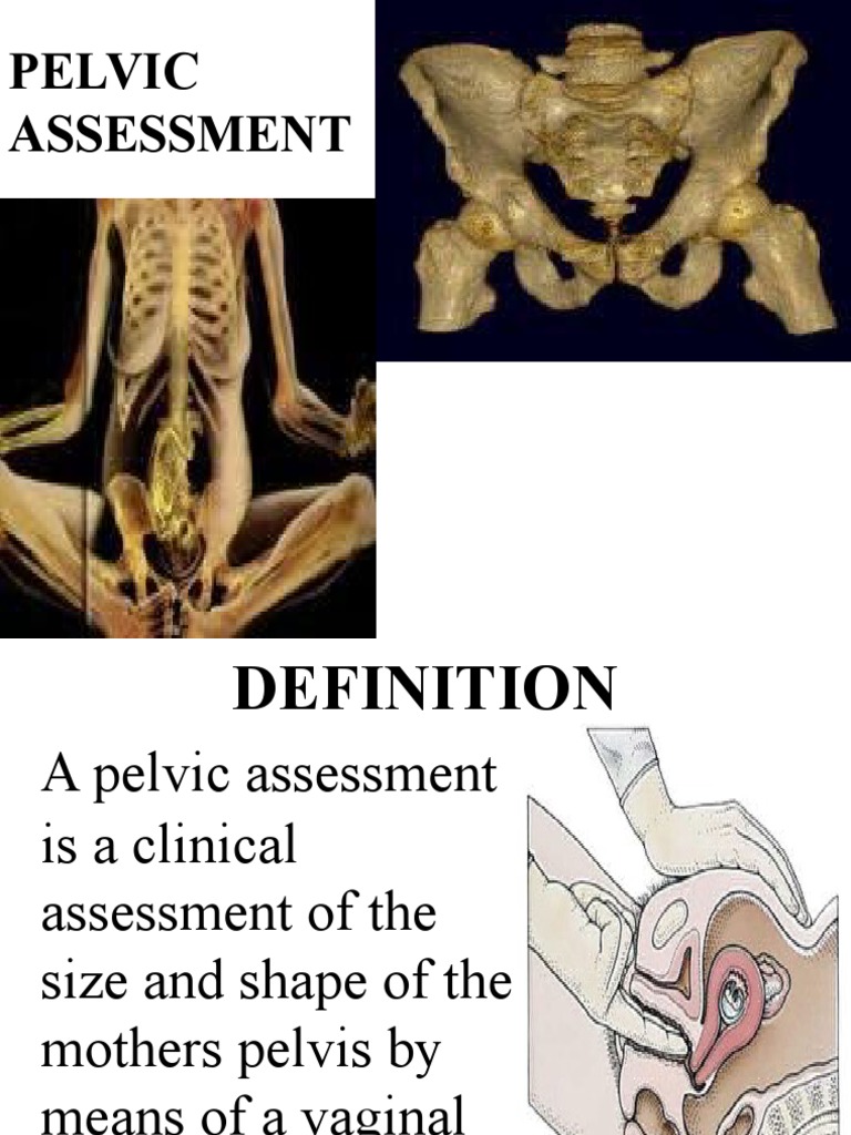 Pelvic Assessment Maternity Nursing Pdf
