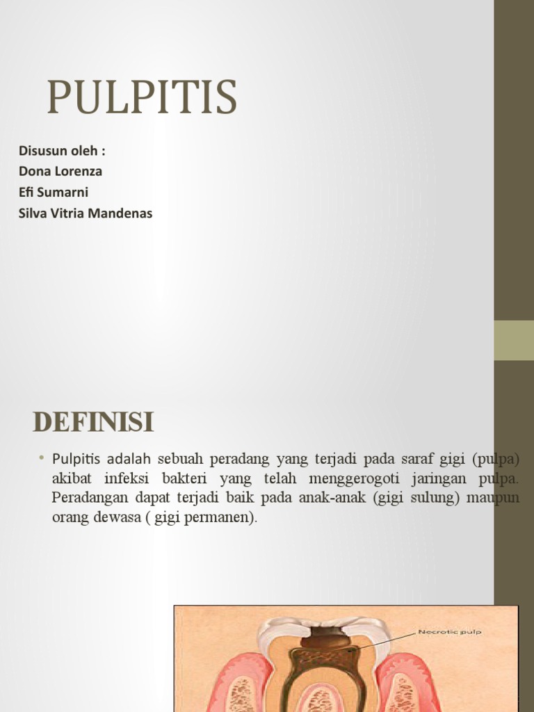 Pulpitis Fix | PDF