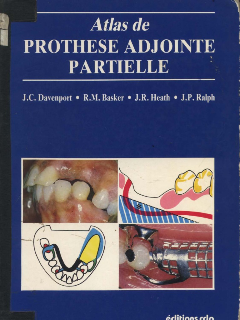 Atlas de Prothese Adjointe Partielle PDF | PDF