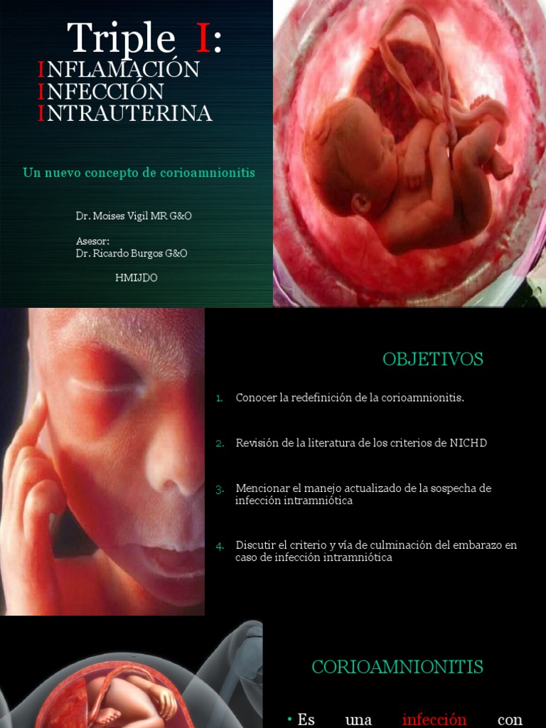 Triple I | PDF | Parto | Parto prematuro