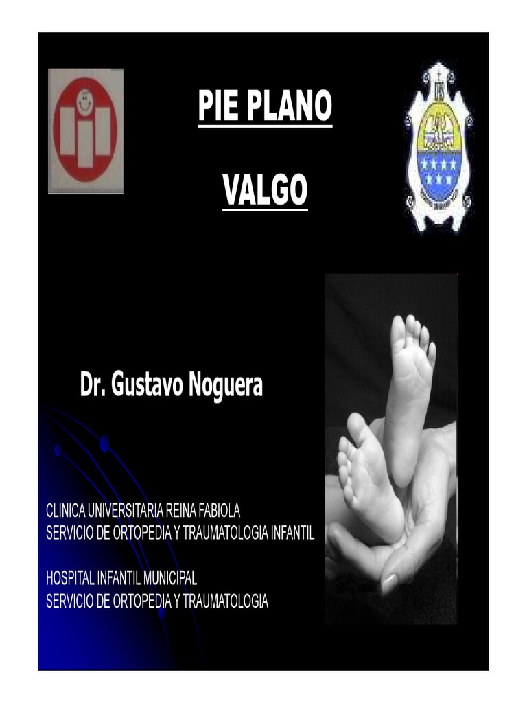 Pie Valgo PDF | PDF | Pie | Extremidades (anatomía)