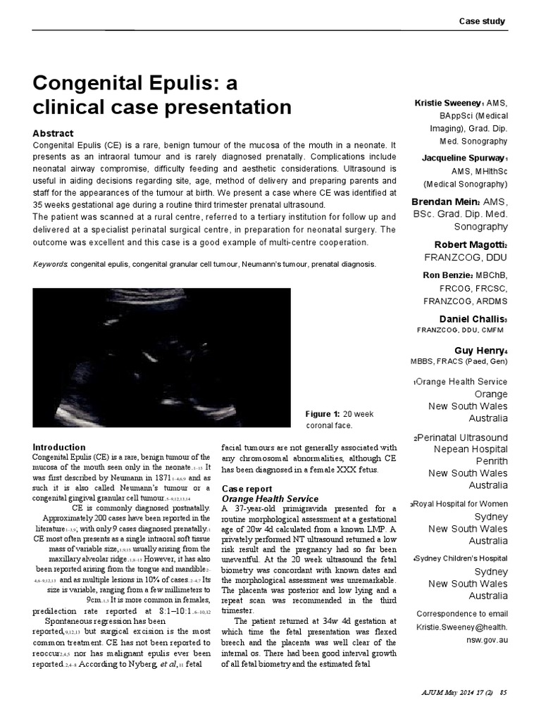 Congenital Epulis: A Clinical Case Presentation: Bsc. Grad. Dip. Med. Sonography | PDF | Fetus ...