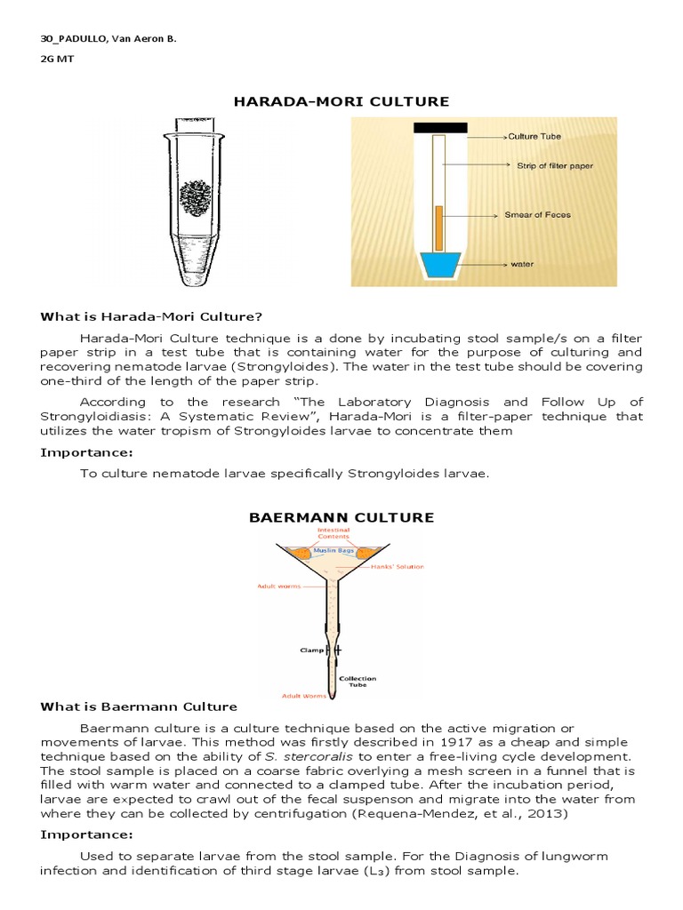What Is Harada-Mori Culture? | PDF | Immunology | Medical Specialties