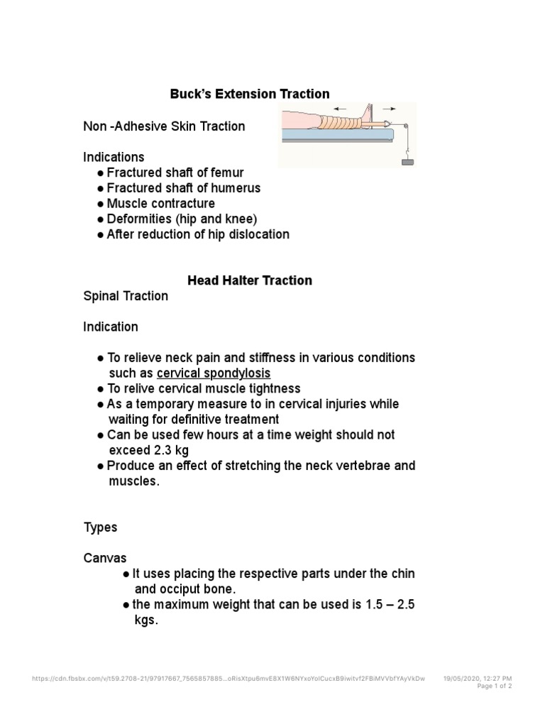 Buck's Extension Traction: 19/05/2020, 12Q27 PM Page 1 of 2 | PDF