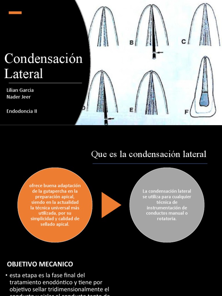 EndoII Condensacion Lateral | PDF | Materiales | Química