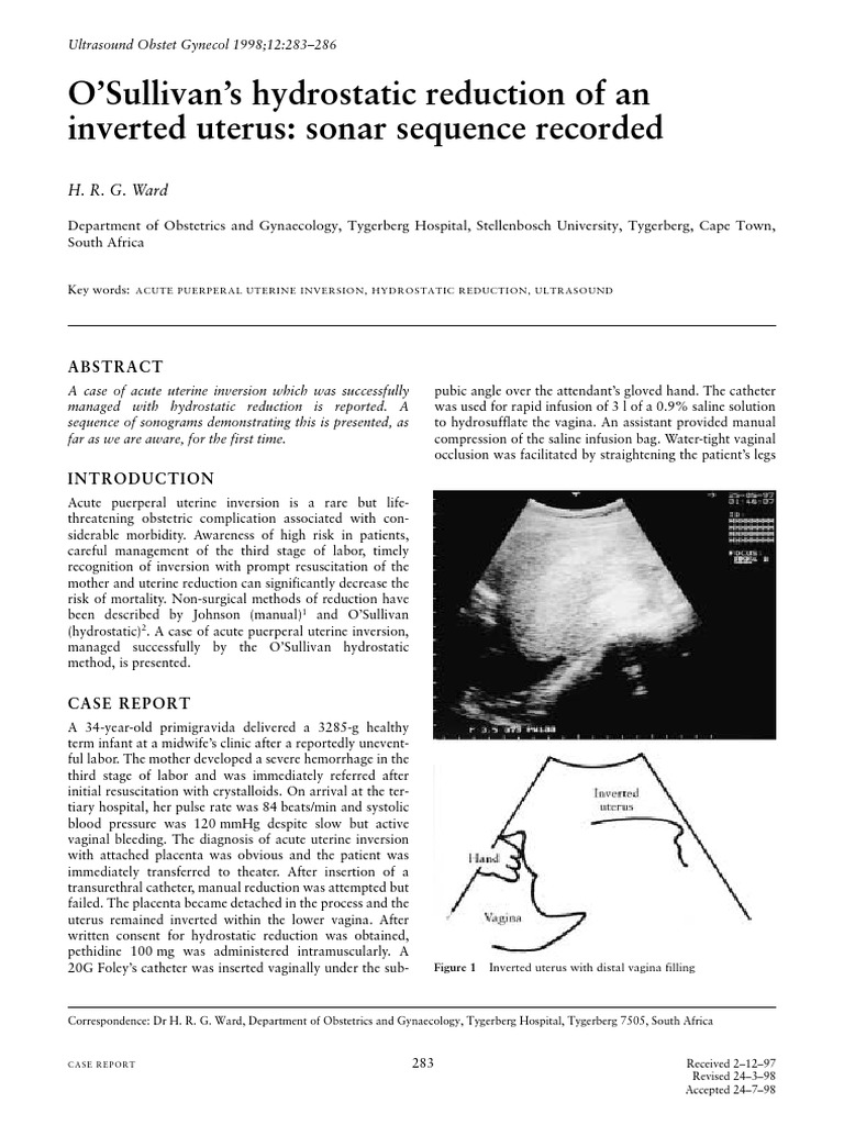 O'Sullivan's Hydrostatic Reduction of An Inverted Uterus: Sonar ...
