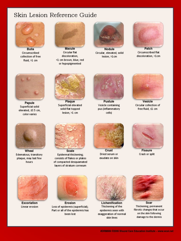 Skin Problems Chart | PDF | Epidermis | Skin