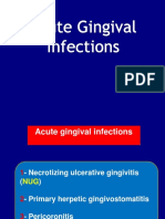 Understanding Linear Gingival Erythema | PDF | Periodontology | Medicine