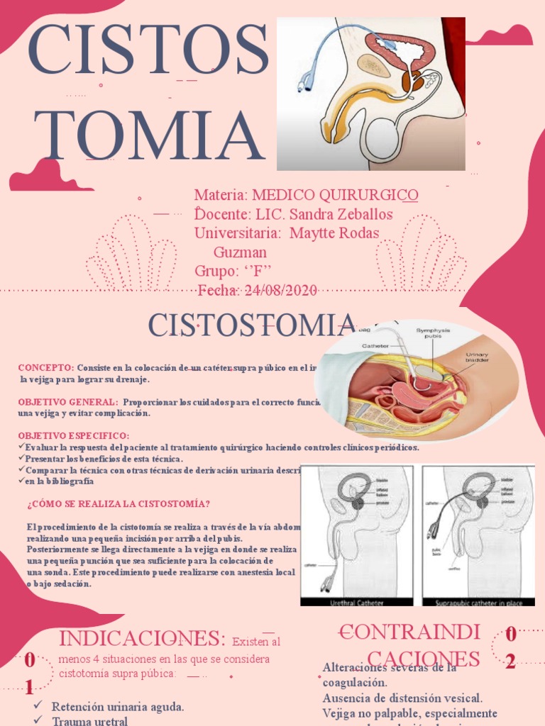 Cistotomia Diapositiva | PDF | Vejiga urinaria | Abdomen