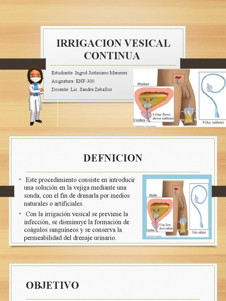 Irrigacion v. C. Enf | PDF | Vejiga urinaria | Urología