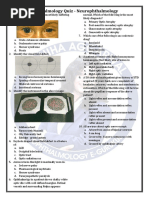 Laparoscopic Cholecystectomy With IOC | PDF | Gallbladder | Liver